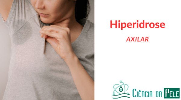 Hiperidrose Axilar: Primária e secundária - Ciência da Pele