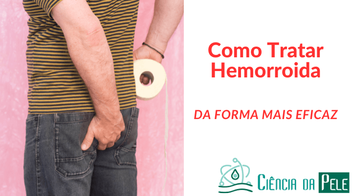 Como Tratar Hemorroida: Dicas para Combater Sintomas - Ciência da Pele