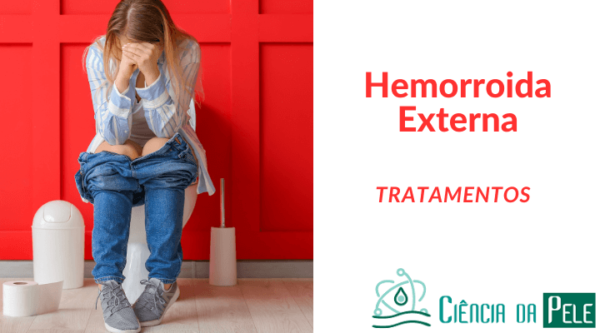 Hemorroida Externa: Causas, Sintomas e Tratamentos - Ciência da Pele